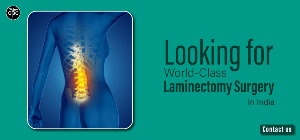Laminectomy Treatment Cost in India | Laminectomy Surgery in Delhi