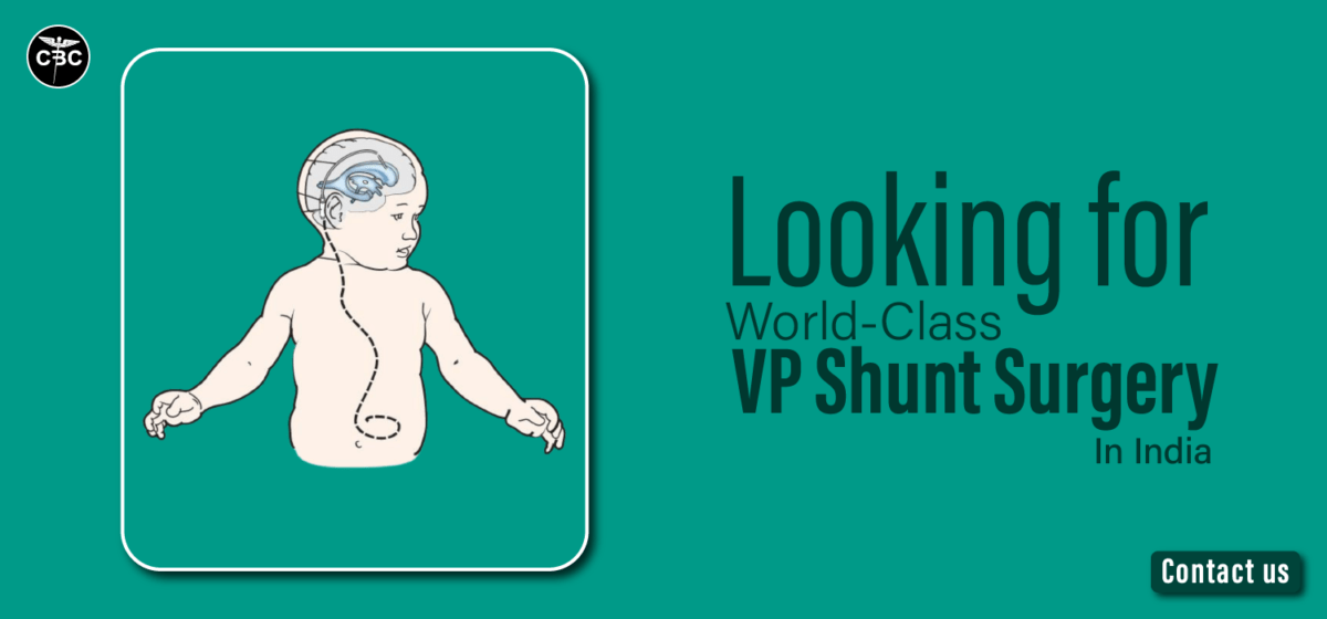 VP Shunt Surgery Cost In India Cross Borders Care VP Shunt Surgery Cost In India Cross Borders Care