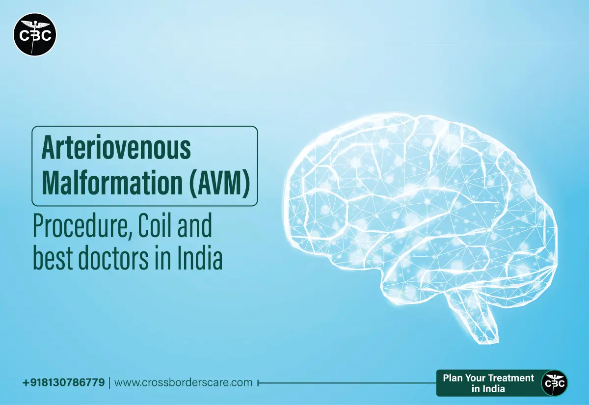 AVM Treatment in India: Procedure & Top Doctors